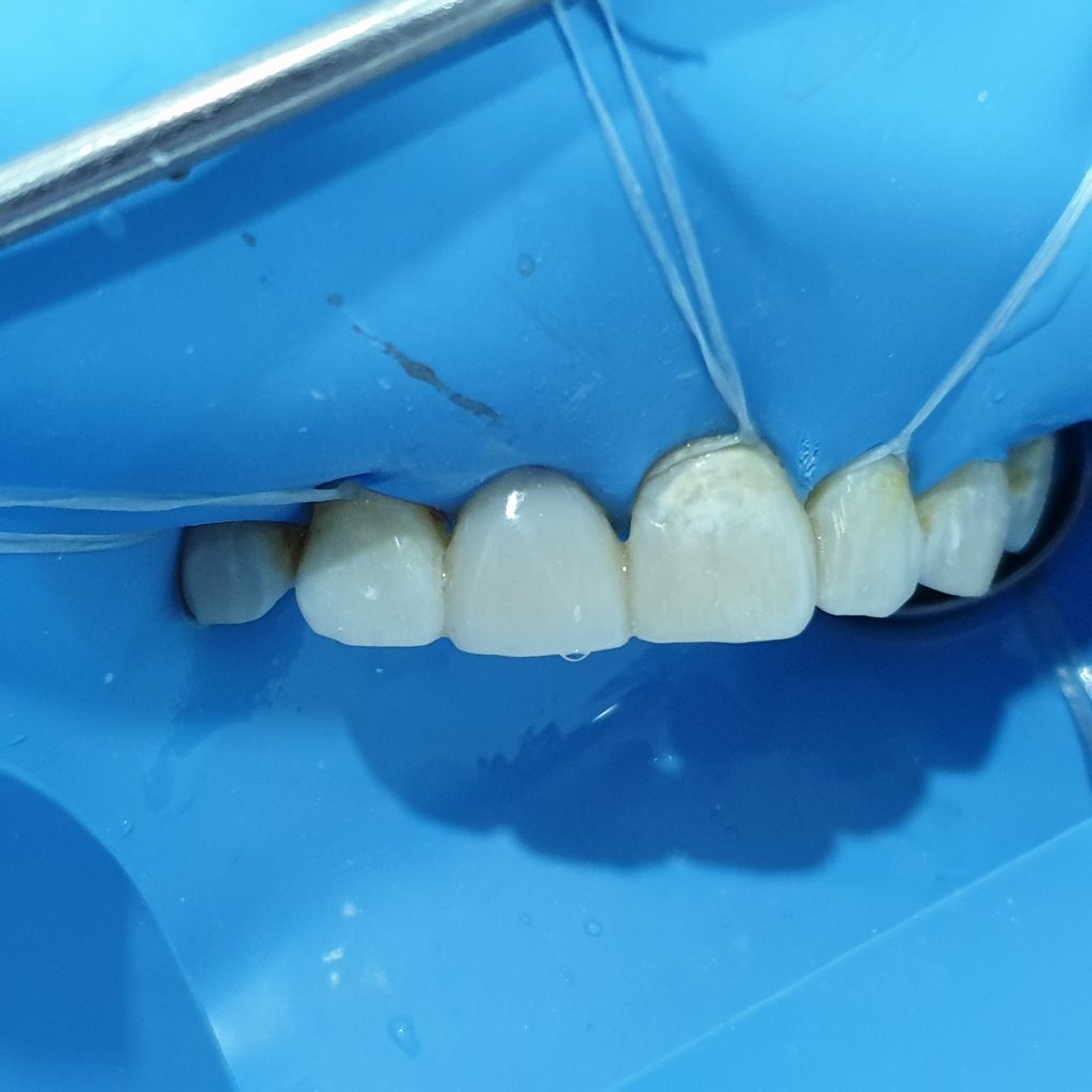 FRC bridge treatment just in time for Raya celebration: Dr Nik – Klinik ...